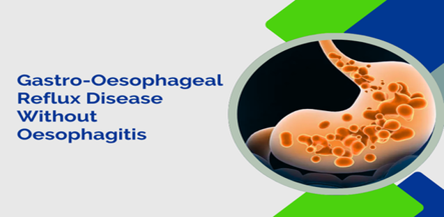 Gastro-Oesophageal Reflux Disease Without Oesophagitis | Dr. Ksheetij ...